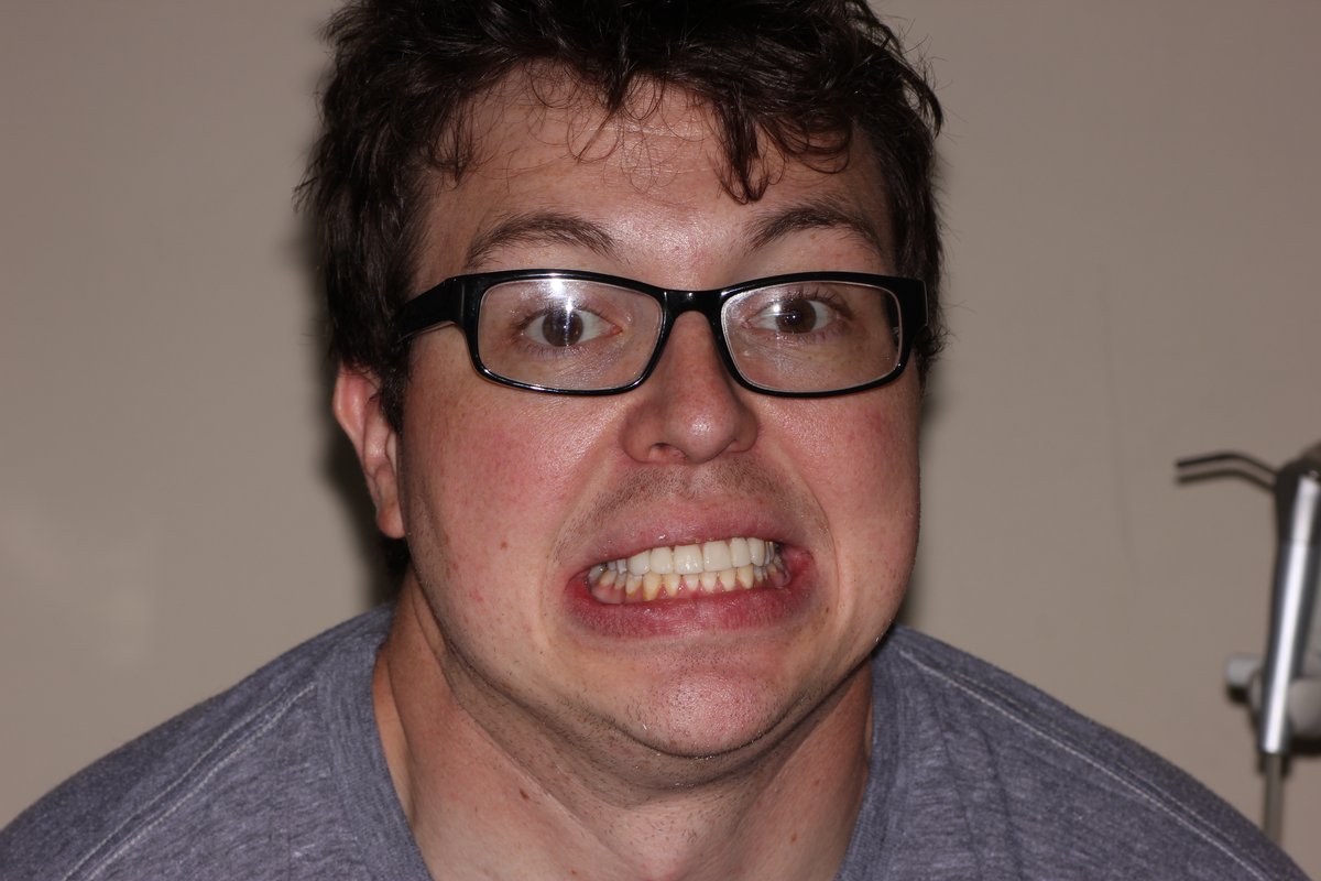 Smile Gallery - Roy Dental Care