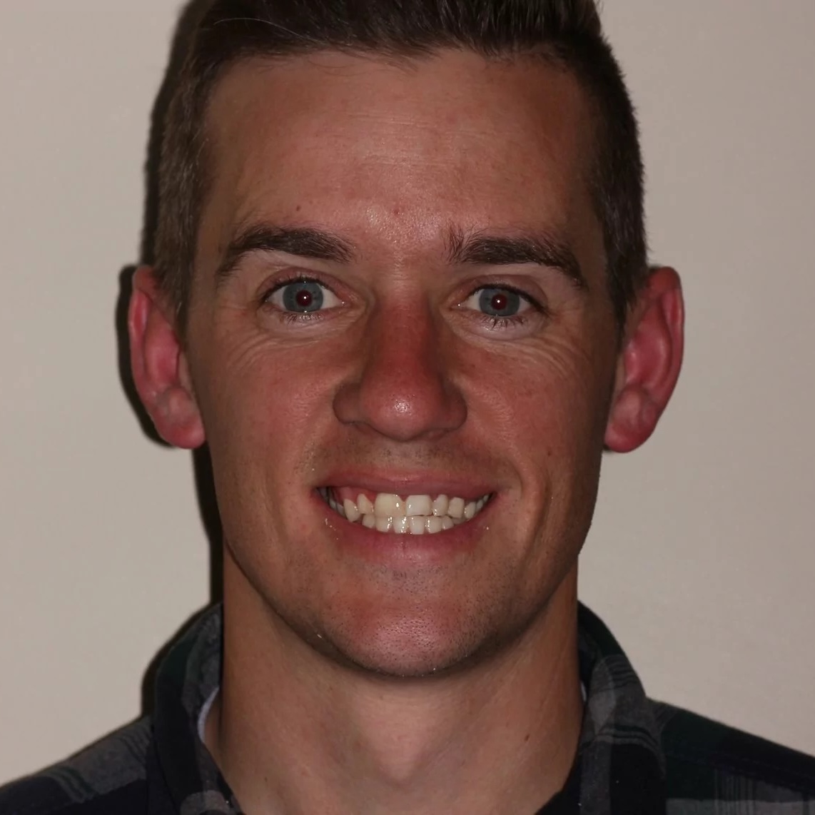 Smile Gallery - Patient Before & After Photos - Roy Dental Care